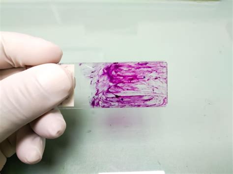 Premium Photo Stained Histology Slide Which Is Ready For Microscopic