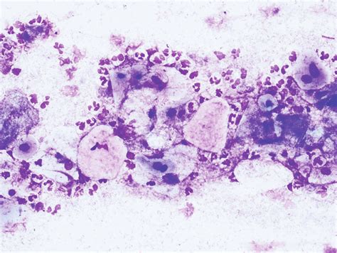 18­ Vaginal Swab From A Ring Tailed Lemur With Septic Suppurative