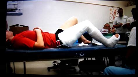 Long Leg Cast Youtube