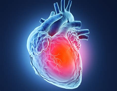 Patients With Hyperkalemia At Risk For Atrial Fibrillation Docwire News
