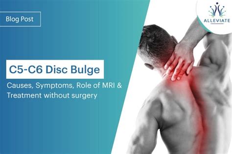 Cervical Disc Herniation Symptoms