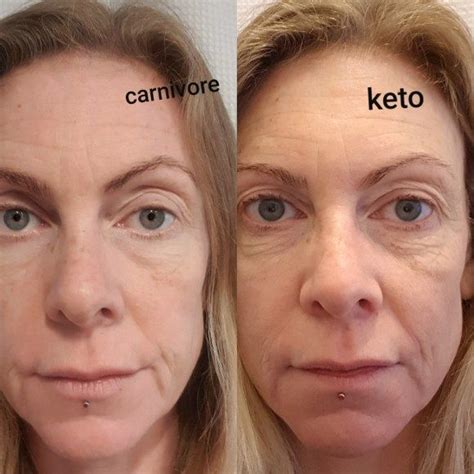 Carnivore Diet Success Stories With Tani Artofit