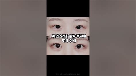 자연스러운 쌍수 추구미 여기 주목 제로원성형외과 눈성형 눈수술 쌍수 쌍꺼풀 속쌍 인라인 인아웃라인 눈성형후기 눈성형전후 쌍수후기