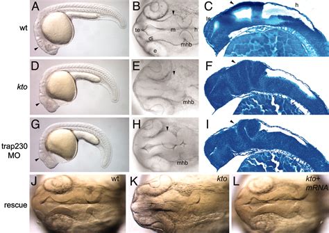 Zebrafish Embryo Brain