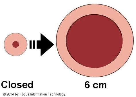 Cervix Dilation Chart Signs Stages And Procedure To Check 59 Off