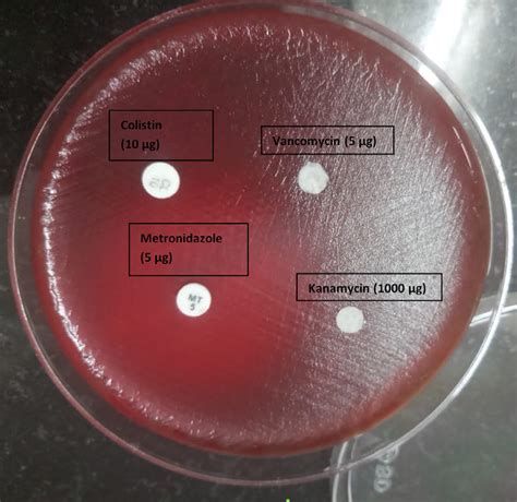 Identification Of Bacteroides Fragilis Group Using Discs Vancomycin 5