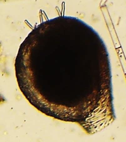 Lesquereusia Spiralis Var Hirsuta Tecamebas