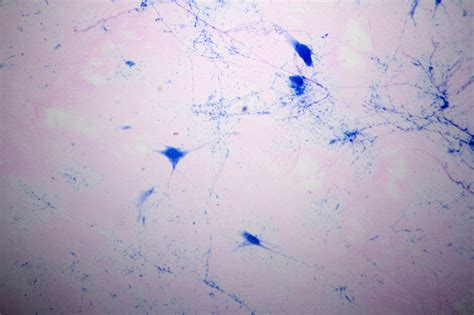 Indoors Body Nervous Nature Art And Craft Axon Medicine