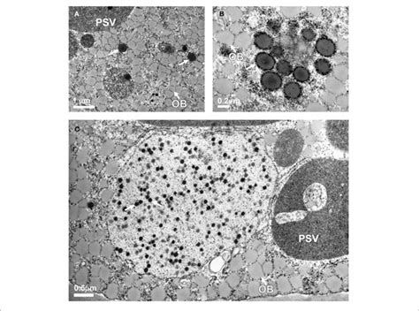 Transmission Electron Microscopy Observation Of Protein Bodies In