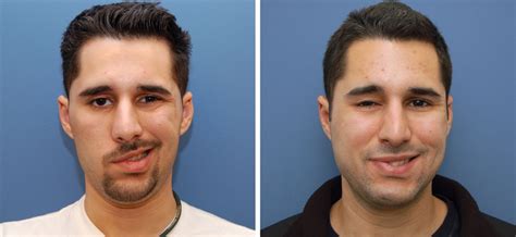 Plastic And Reconstructive Surgery