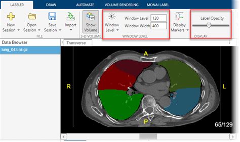 Segment Ct Scan Using Monai Label Matlab And Simulink