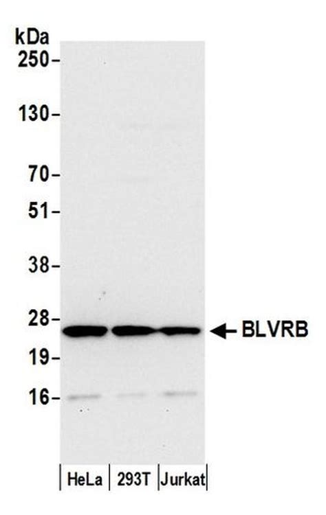 Blvrbbiliverdin Reductase B Polyclonal Antibody A305 570a T