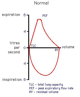 Diagram Of Normal Flow Volume Curve Primary Care Notebook
