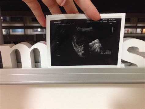 Life In My View My Experience Ev Of Uterus Dilation And Curettage Dandc