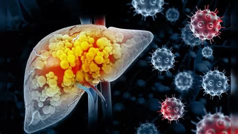 Best Foods For Jaundice Liver Health Superfoods That Help Cure And