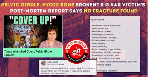 Pelvic Girdle Hyoid Bone Broken R G Kar Victims Post Mortem Report Says No Fracture Found