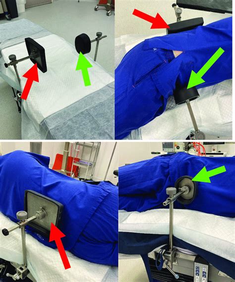 Positioning Support Set Up Demonstrating Rectangular Posterior Sacral Download Scientific