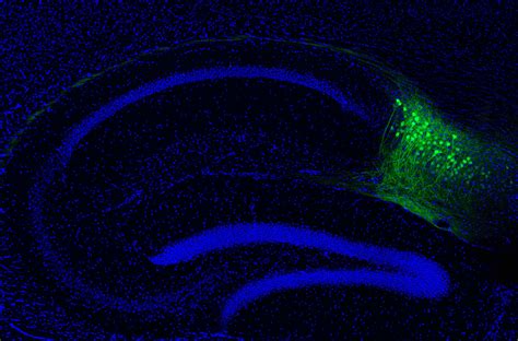 Memory Retrieval Needs A Neuronal Connecting Flight It Aint Magic