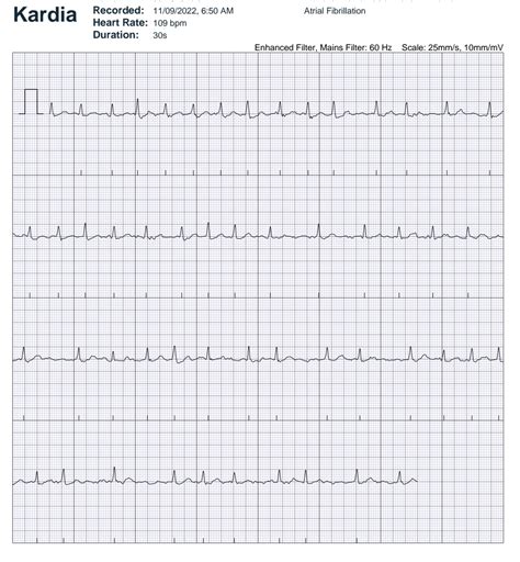 Heart Stuff Update Electronics Forum Circuits Projects And
