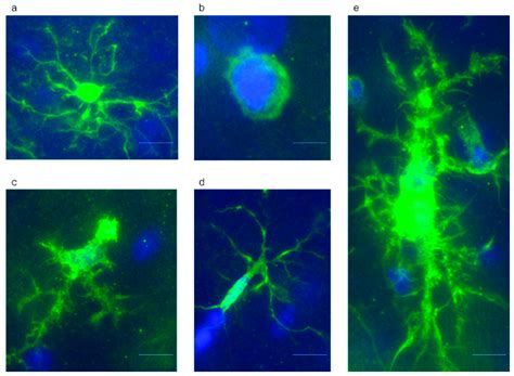 Representative Microphotographs Of Microglial Cells Of Different Download Scientific Diagram