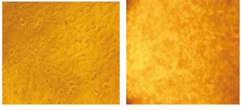 Scopuloides Hydnoides Semantic Scholar