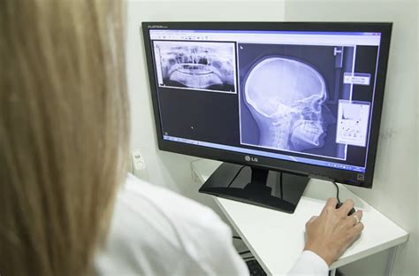 Ferramenta De Ia Acelera Análise De Imagens Médicas