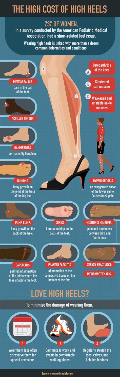 How To Treat Your Feet Get The Right Fit With Your Footwear Foot