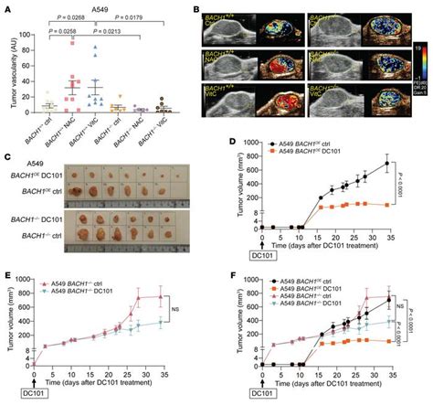 Jci Antioxidants Stimulate Bach1 Dependent Tumor Angiogenesis