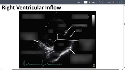 Labeling Rvit Diagram Quizlet