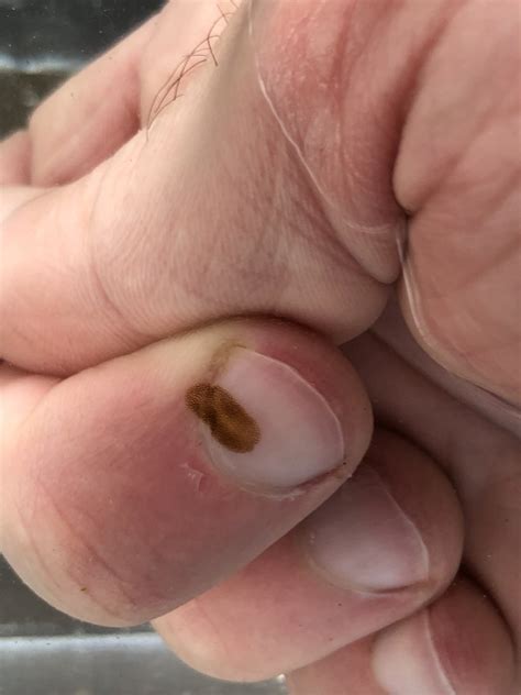 Pest Flatworm Reef2reef