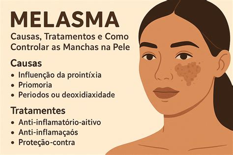 Melasma Causas Tratamentos E Controle De Manchas