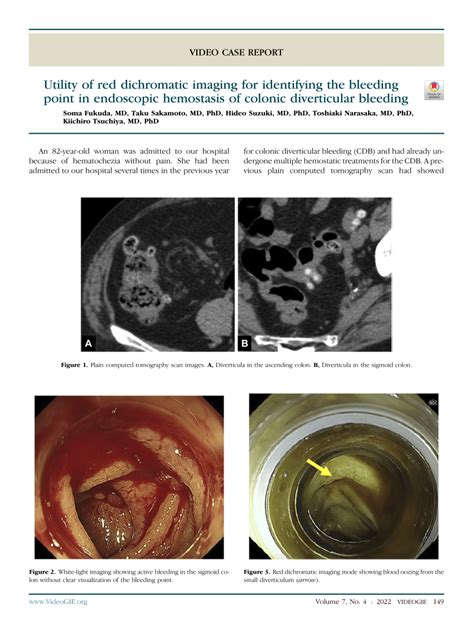 Pdf Utility Of Red Dichromatic Imaging For Identifying The Bleeding Point In Endoscopic