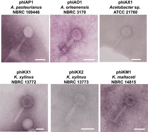Tem Photographs Of Temperate Phages Produced By Acetic Acid Bacteria Download Scientific