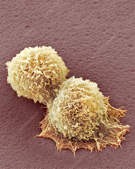 Sarcoma Cells Sem Stock Image M132 1001 Science Photo Library