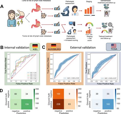 Deep Learning Trained On Lymph Node Status Predicts Outcome From Gastric Cancer Histopathology