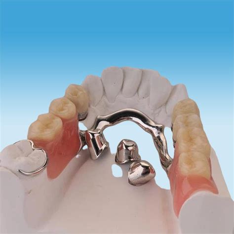 China Cheap Strong Precision Attachment Bridge Manufacturers Suppliers