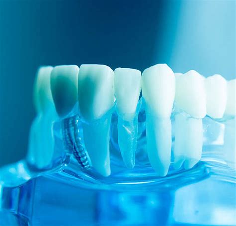 Implante Dentario No Rio De Janeiro SB Ortoimplante Clinica Odontologica Dentista No Rio De