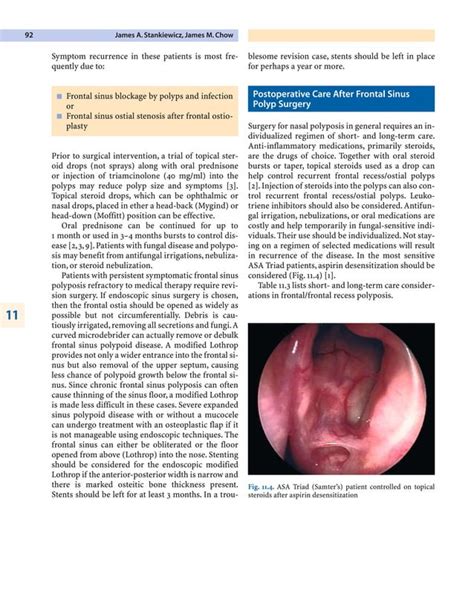 Diseases Of Frontal Sinus Pdf