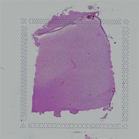 GitHub LieberInstitute SpatialLIBD Code For The SpatialLIBD R Bioconductor Package And Shiny App