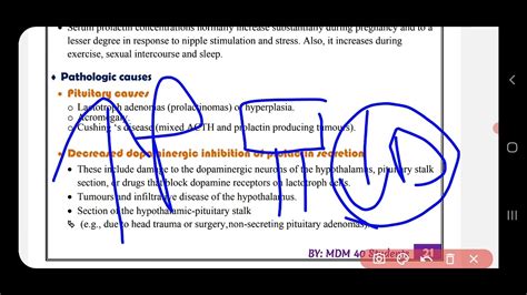 The K O In Endocrine Hyperprolactinemia And Galactorrhea Youtube