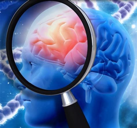 Tumor Cerebral ¿qué Es Causas Y Síntomas