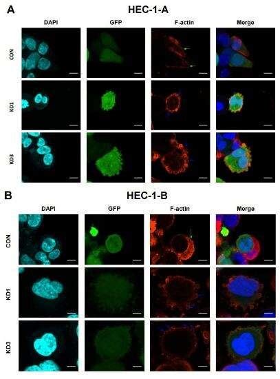 Effects Of Cttn Knockdown On Pseudopodia In Ec Cells Representative