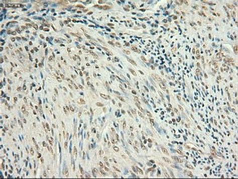 C Myc Antibody Ta500002