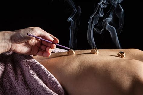 25 Facts About Traditional Healing Practices