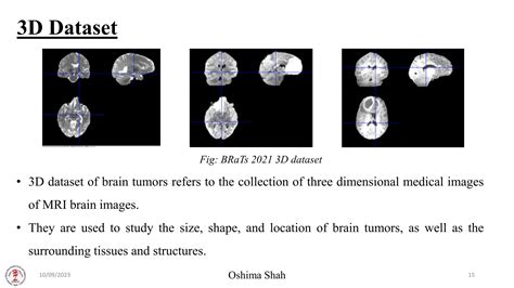 Final Defense Ppt Bratsof Brain Tumor Segmentationpptx