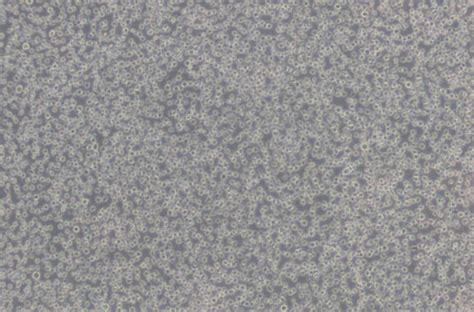 Jurkat Clone A3 A3 人t淋巴细胞白血病细胞价格 Jurkat Clone A3 A3 人t淋巴细胞白血病细胞说明书 上海通蔚