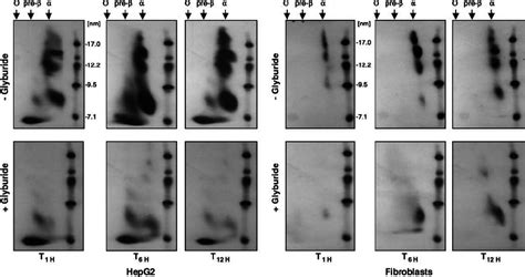 Time Course Analysis Of The Formation Of Lpa I Generated By The