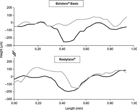 Hyaluronic Acid Fillers With Cohesive Polydensified Matrix For Soft Ti