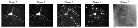Python Pixel Size And Dimensions — Introduction To Bioimage Analysis