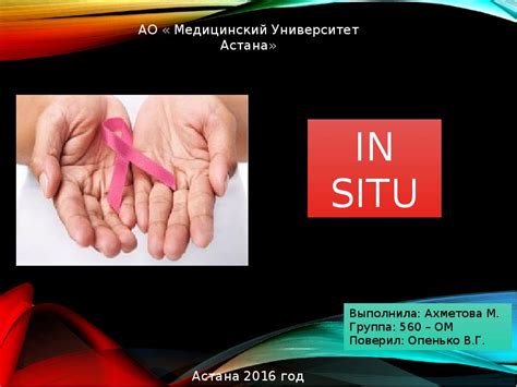 Рак In Situ презентация доклад проект скачать